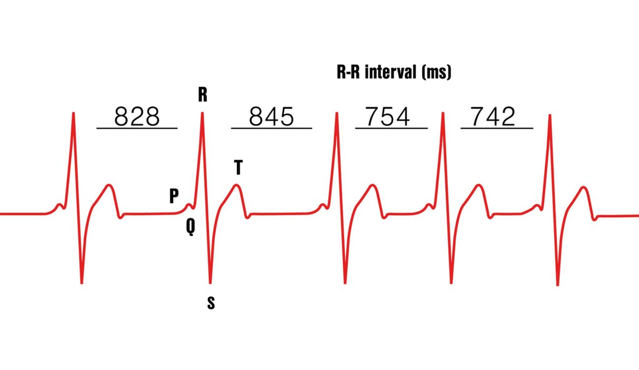 Was ist die Herzratenvariabilität (HRV) und wieso ist sie wichtig ...